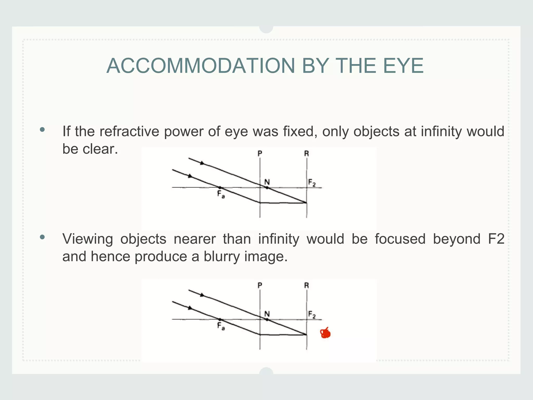 Accommodation by the eye.pptx
