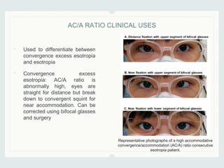 Accommodation by the eye.pptx