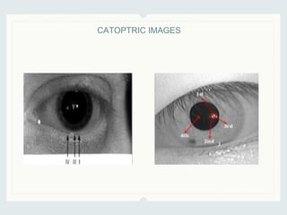 Accommodation by the eye.pptx