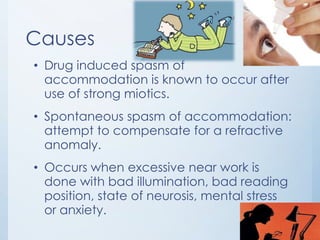 Accommodation of eye | PPTX