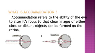 Accommodation reflex opthamalogy mbbs pptx slides | PPTX