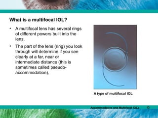 Accommodative and multifocal intraocular lenses | ODP