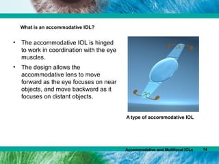 Accommodative and multifocal intraocular lenses | ODP