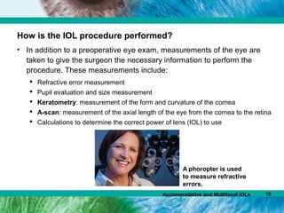 Accommodative and multifocal intraocular lenses | ODP