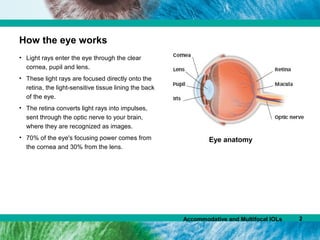Accommodative and multifocal intraocular lenses | ODP