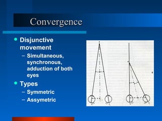 Accommodative and vergence dysfunction | PPT