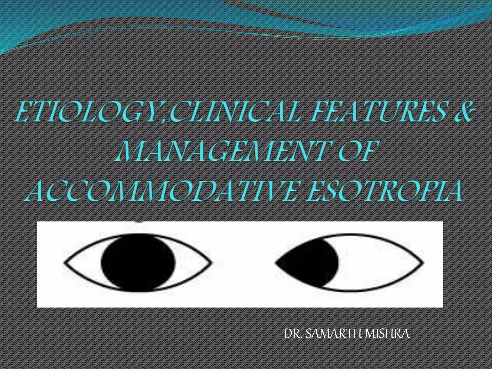 Accommodative esotropia | PPTX