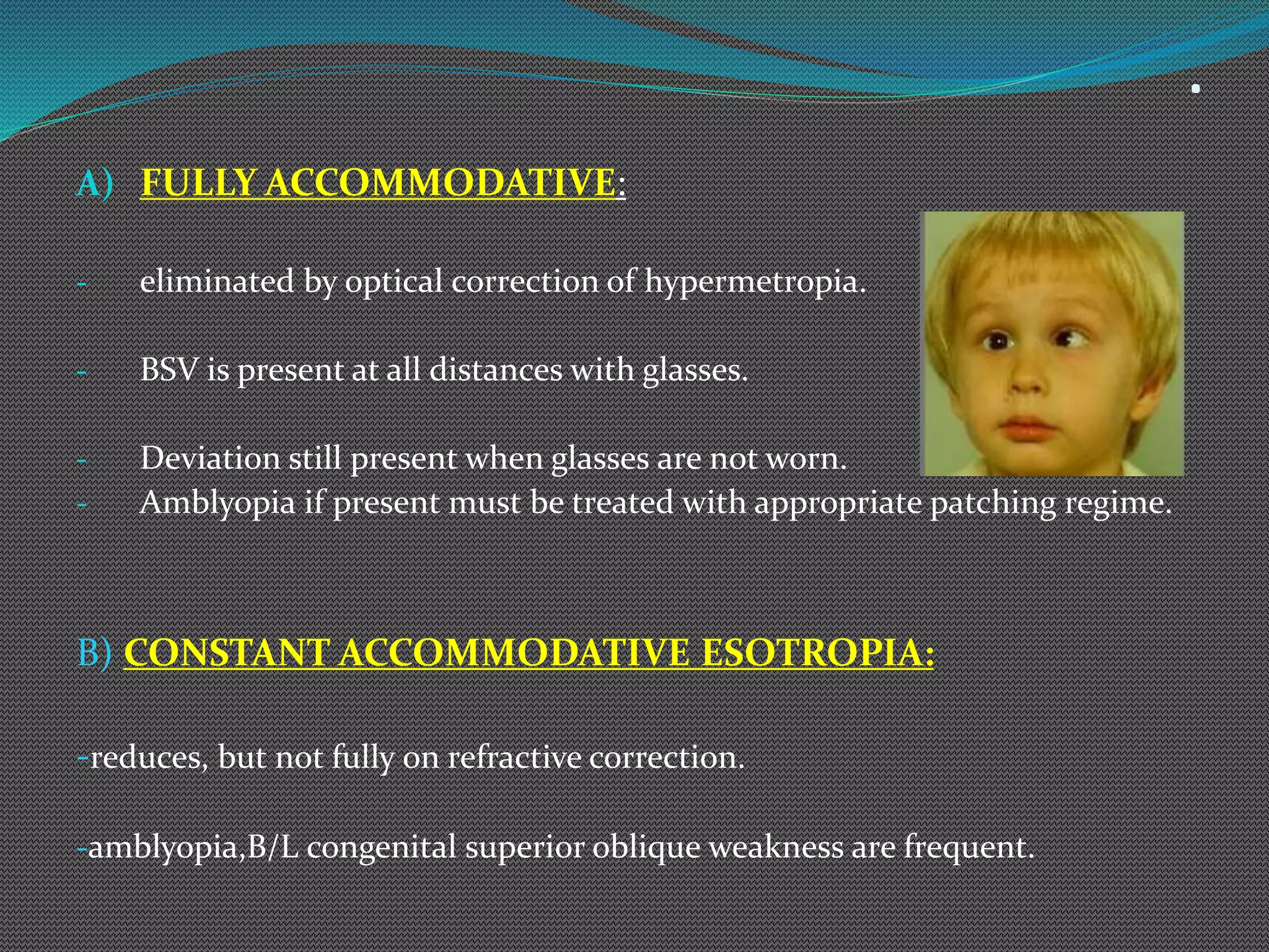 Accommodative esotropia | PPTX