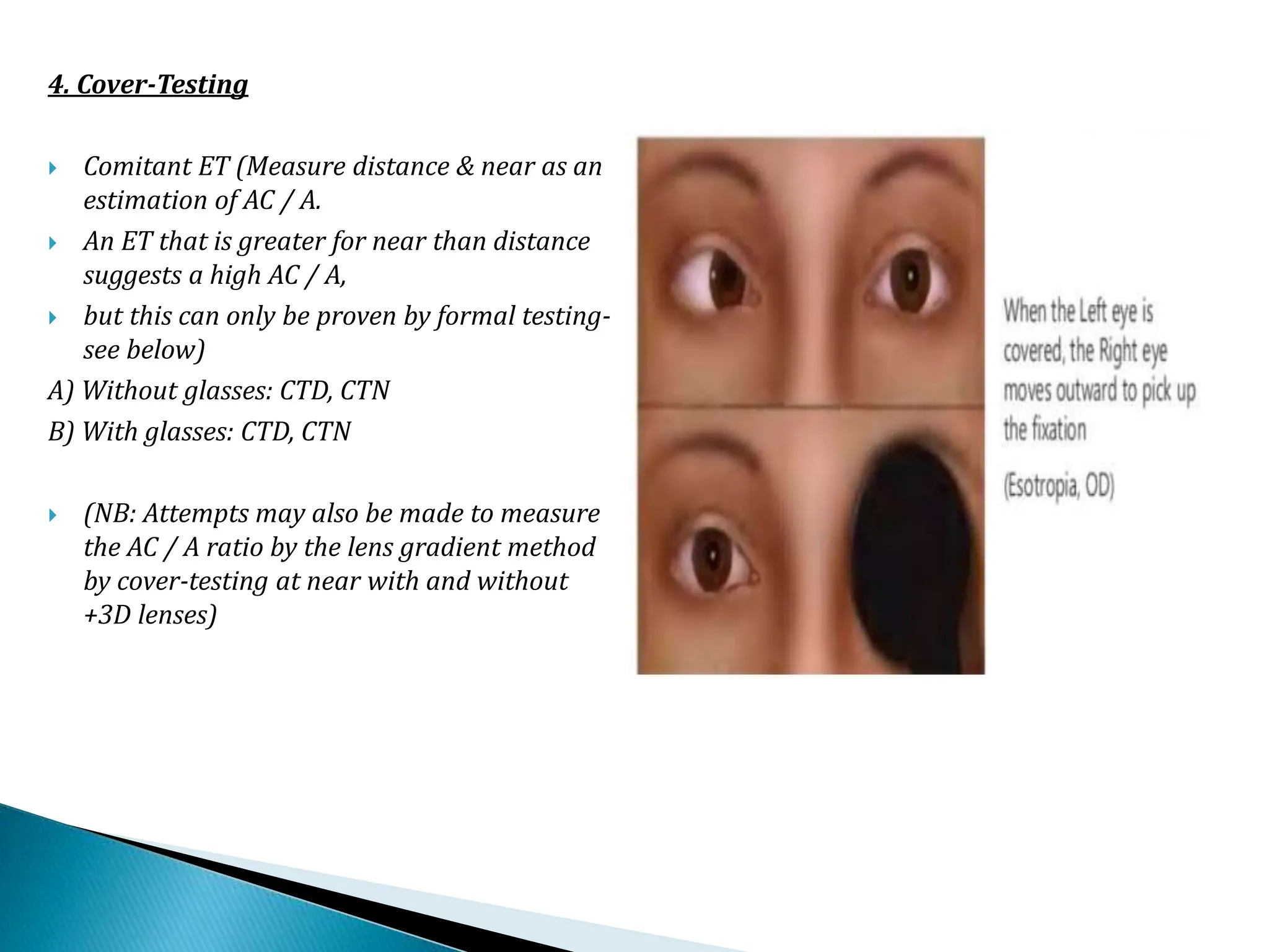 ACCOMMODATIVE ESOTROPIA.pptx............ | PPTX