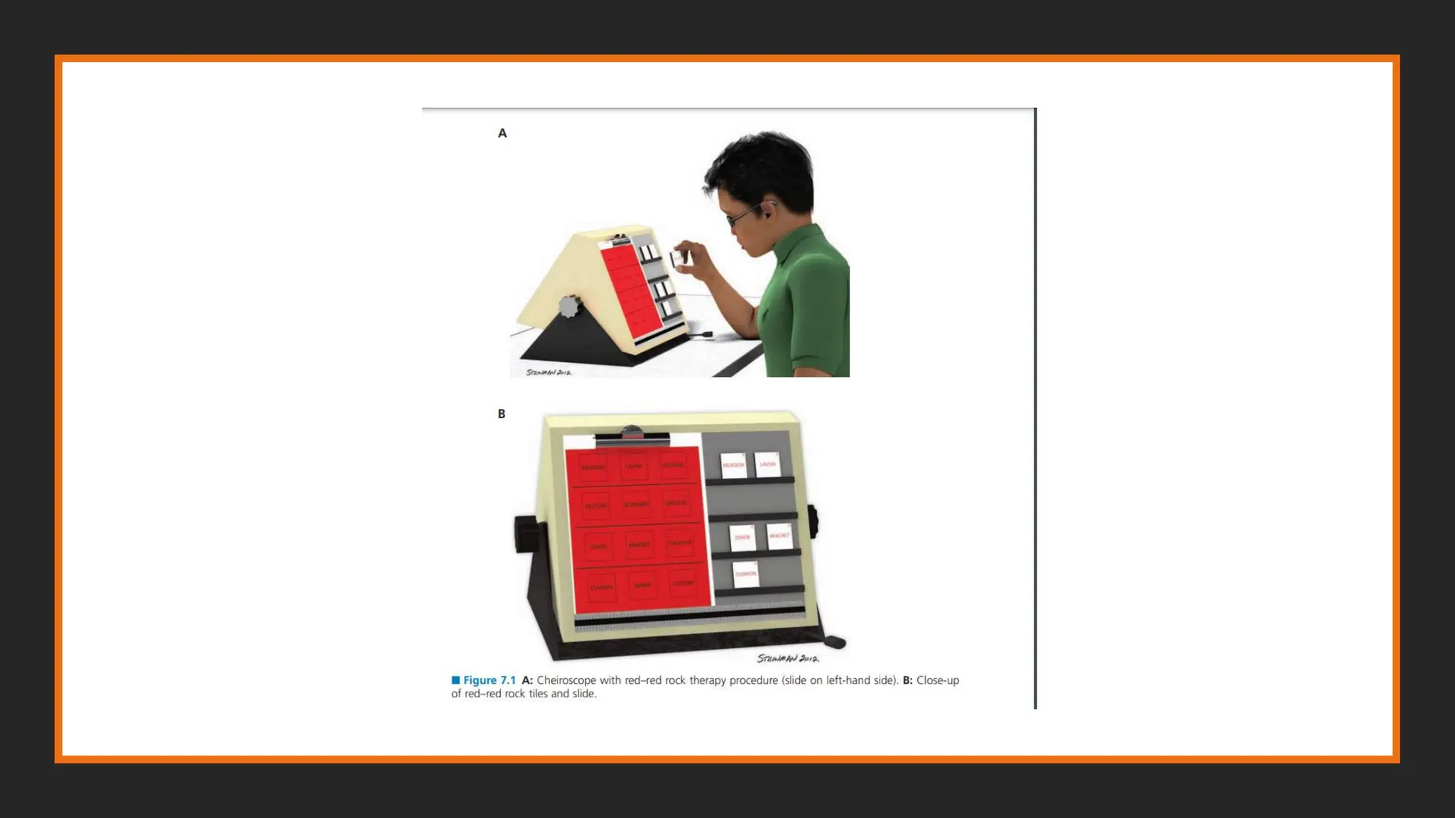 ACCOMMODATIVE VISION THERAPY Jasmin modi | PPTX