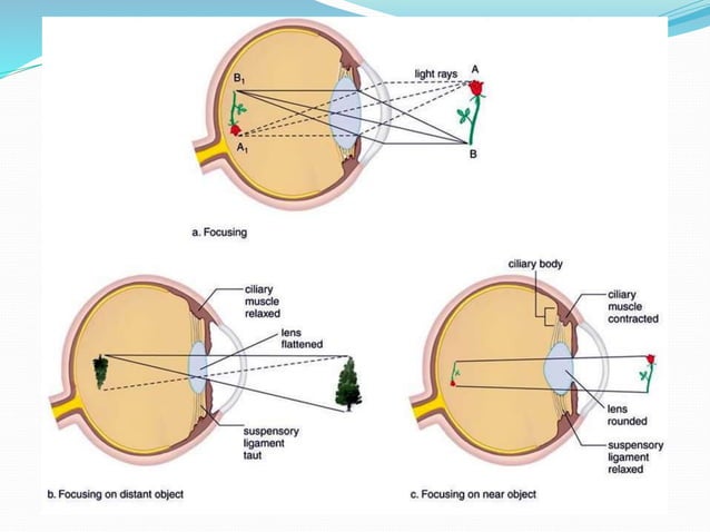 Accomodation reflex | PPTX | Eye and Vision Conditions | Diseases and ...