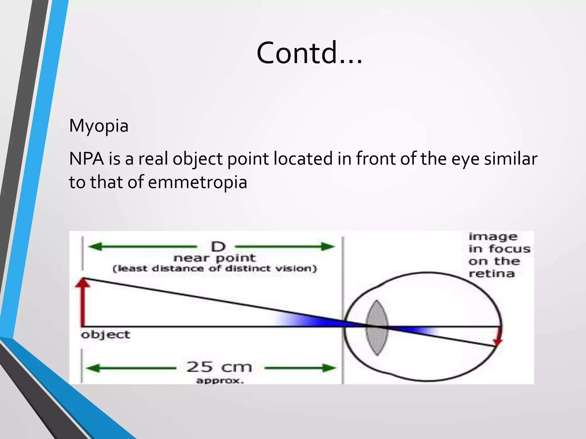 Accommodation: Theories and Mechanism | PPTX | Eye and Vision ...