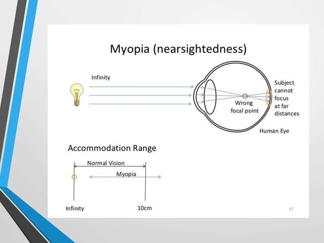 Accommodation: Theories and Mechanism | PPTX | Eye and Vision ...