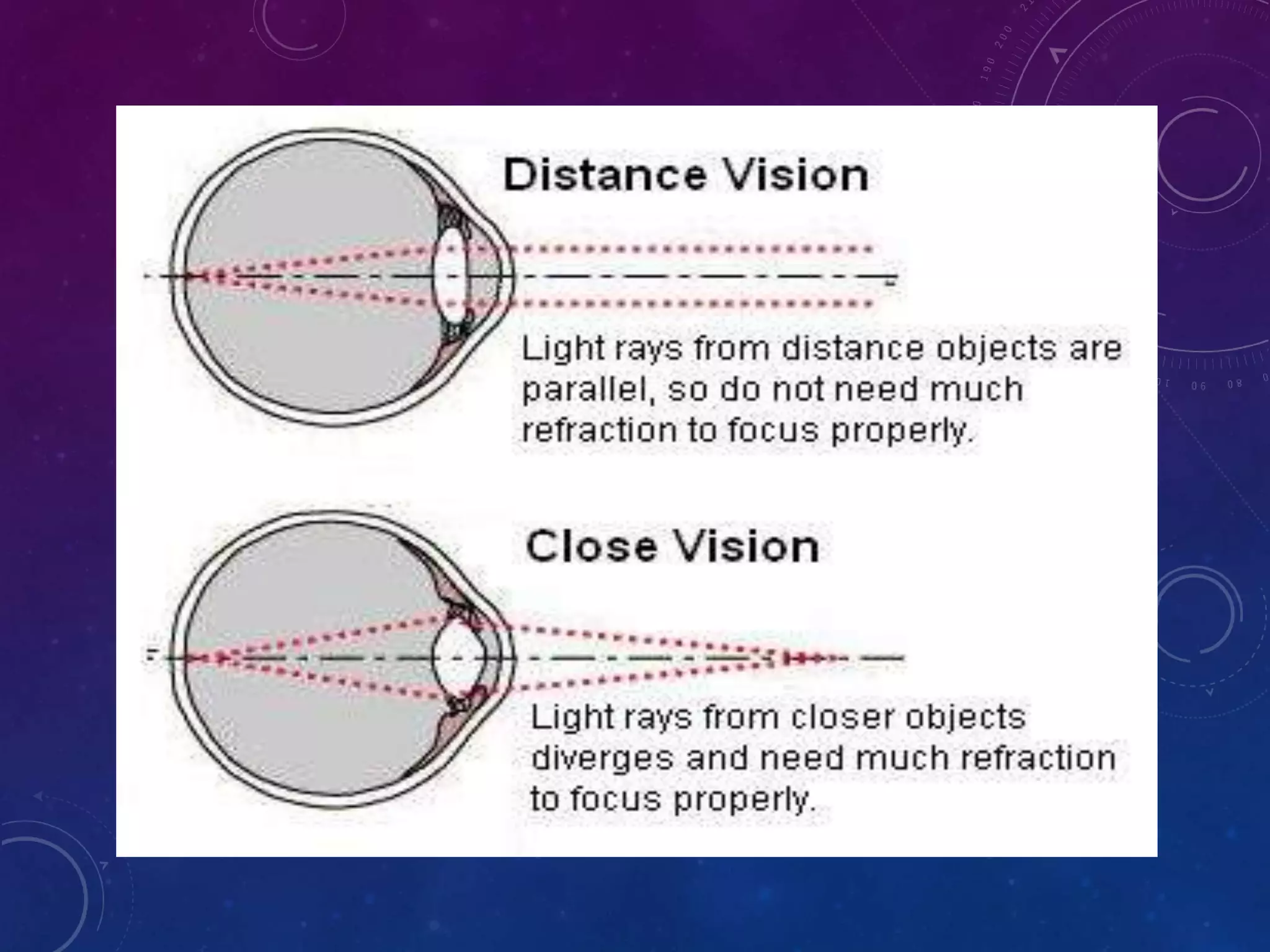 Accomodation and its anomalies | PPTX