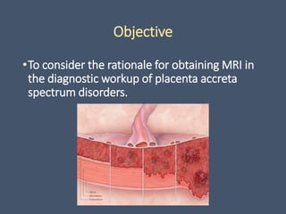 Placenta Accreta Spectrum - The Role for Magnetic Resonance Imaging ...