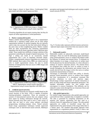 Improved Segmentation Technique for Enhancement of Biomedical Images | PDF