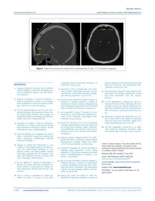 Accuracy of Subthalamic Nucleus Electrode Implantation in Deep Brain ...