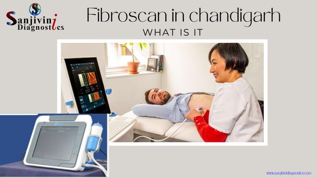 Sanjivini Diagnostics Pioneers Accurate Liver Fibrosis Evaluation Using ...