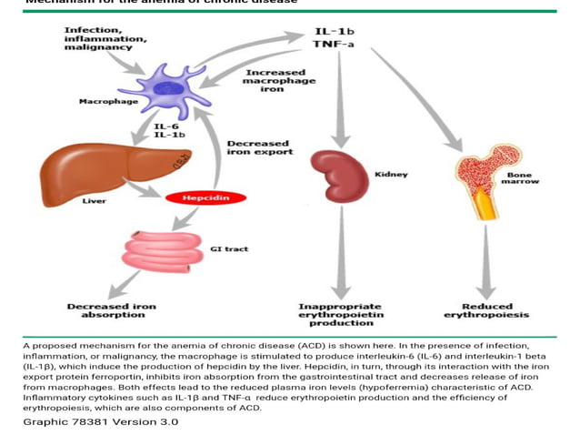 Anemia of chronic disease | PPT