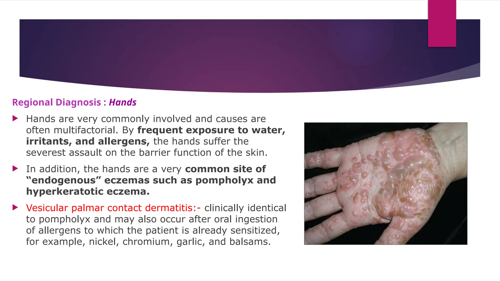 ALLERGIC CONTACT DERMATITIS PRESENTATION , dermatology | PPTX