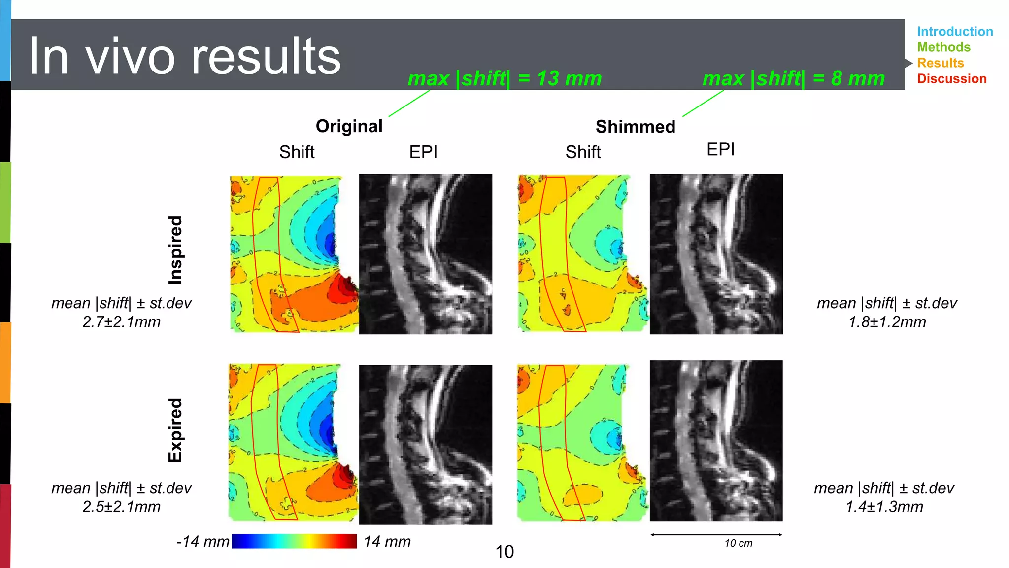 Integrated RF and Shim coils for MRI | PPTX