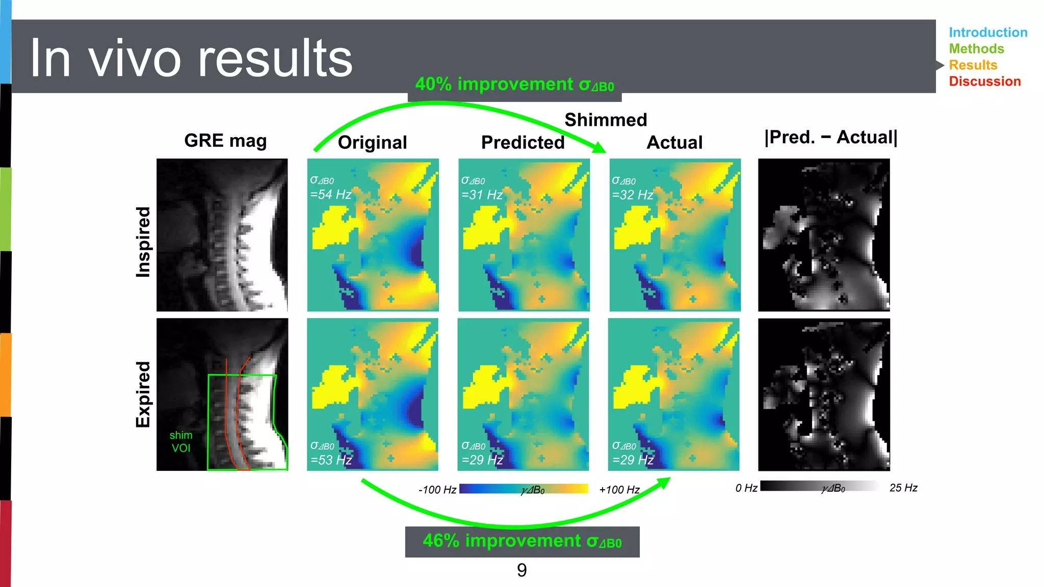 Integrated RF and Shim coils for MRI | PPTX