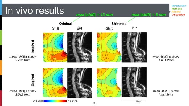 Integrated RF and Shim coils for MRI | PPTX