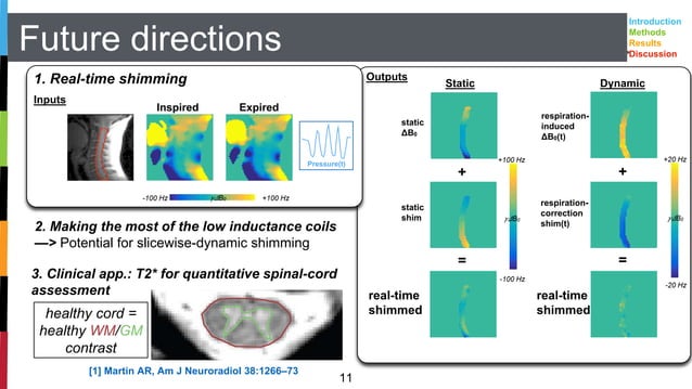 Integrated RF and Shim coils for MRI | PPTX