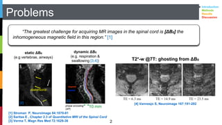Integrated RF and Shim coils for MRI | PPTX