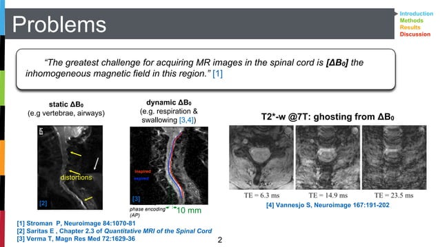Integrated RF and Shim coils for MRI | PPTX