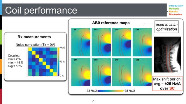 Integrated RF and Shim coils for MRI | PPTX