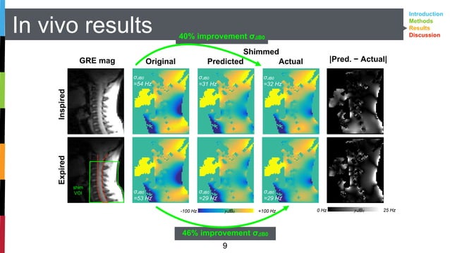 Integrated RF and Shim coils for MRI | PPTX