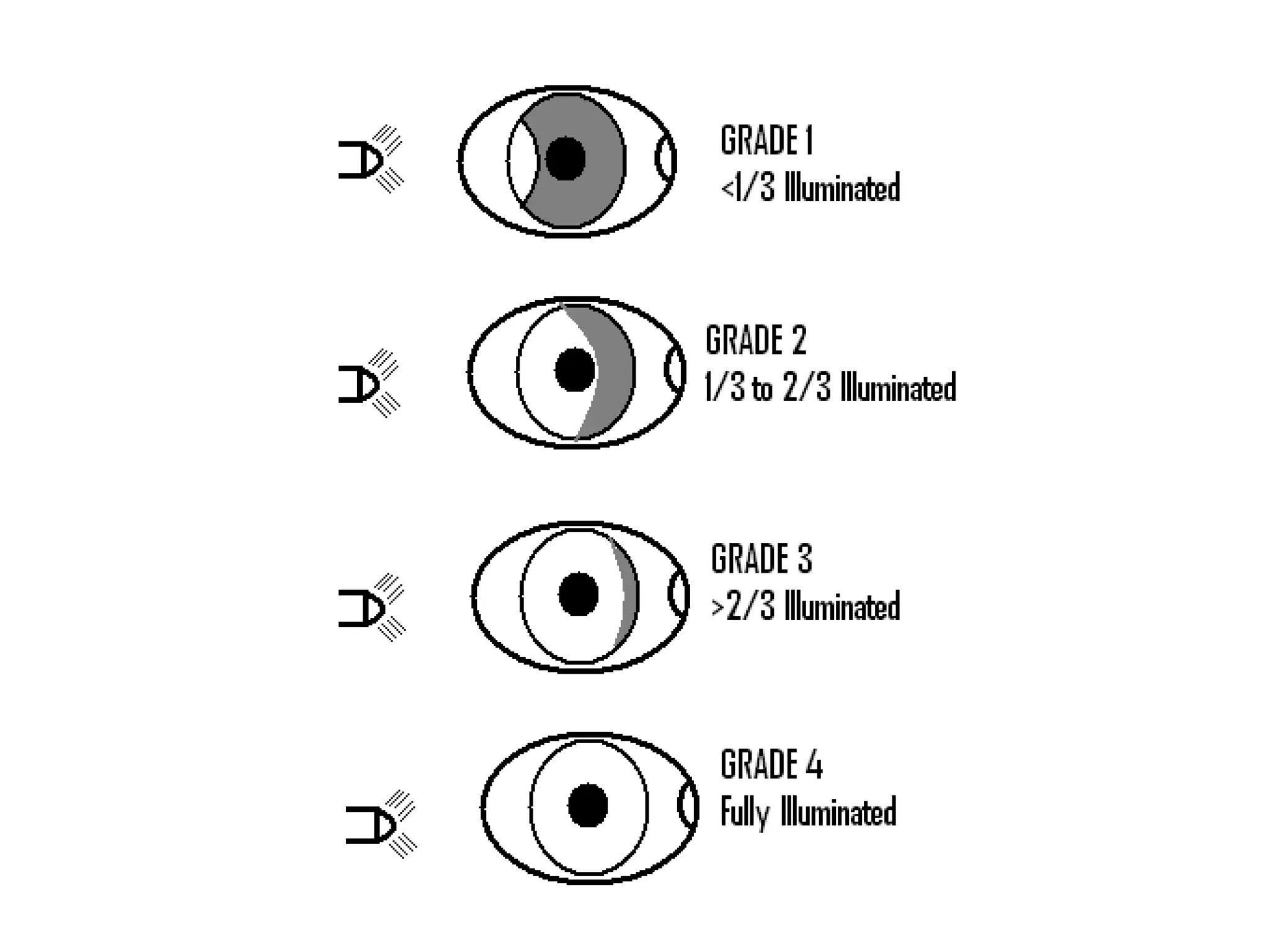 Anterior chamber depth evaluation notes.pptx