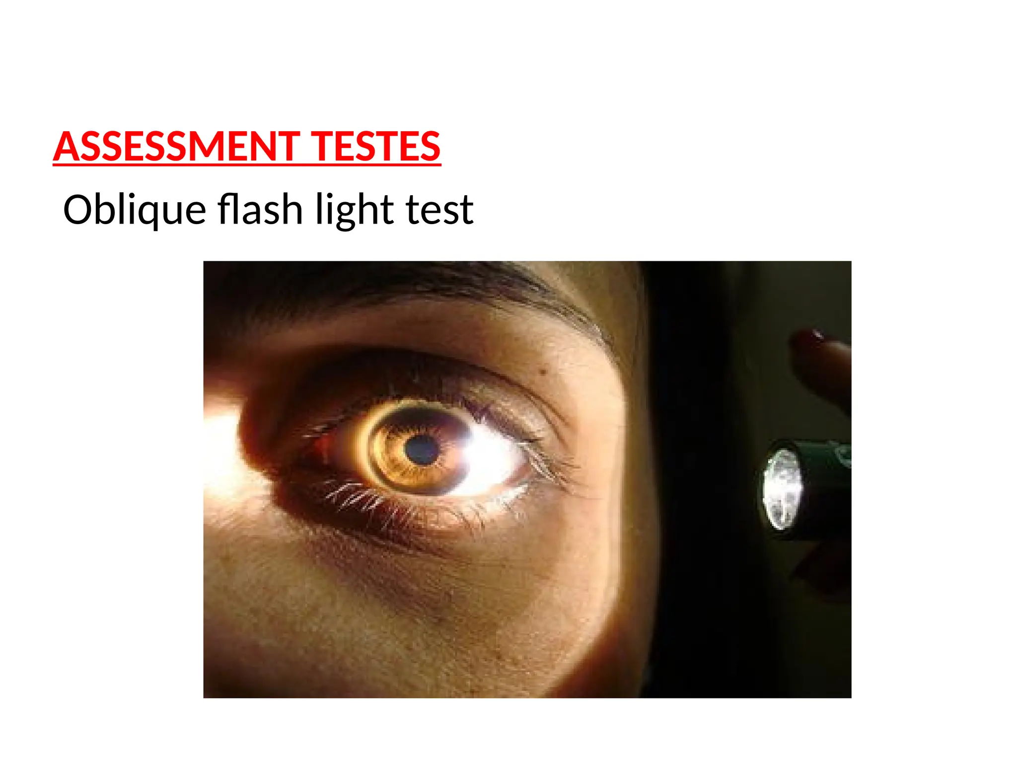 Anterior chamber depth evaluation notes.pptx