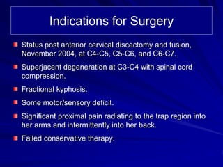 Case Review #4: 51 year old female with adjacent segment degeneration | PPT