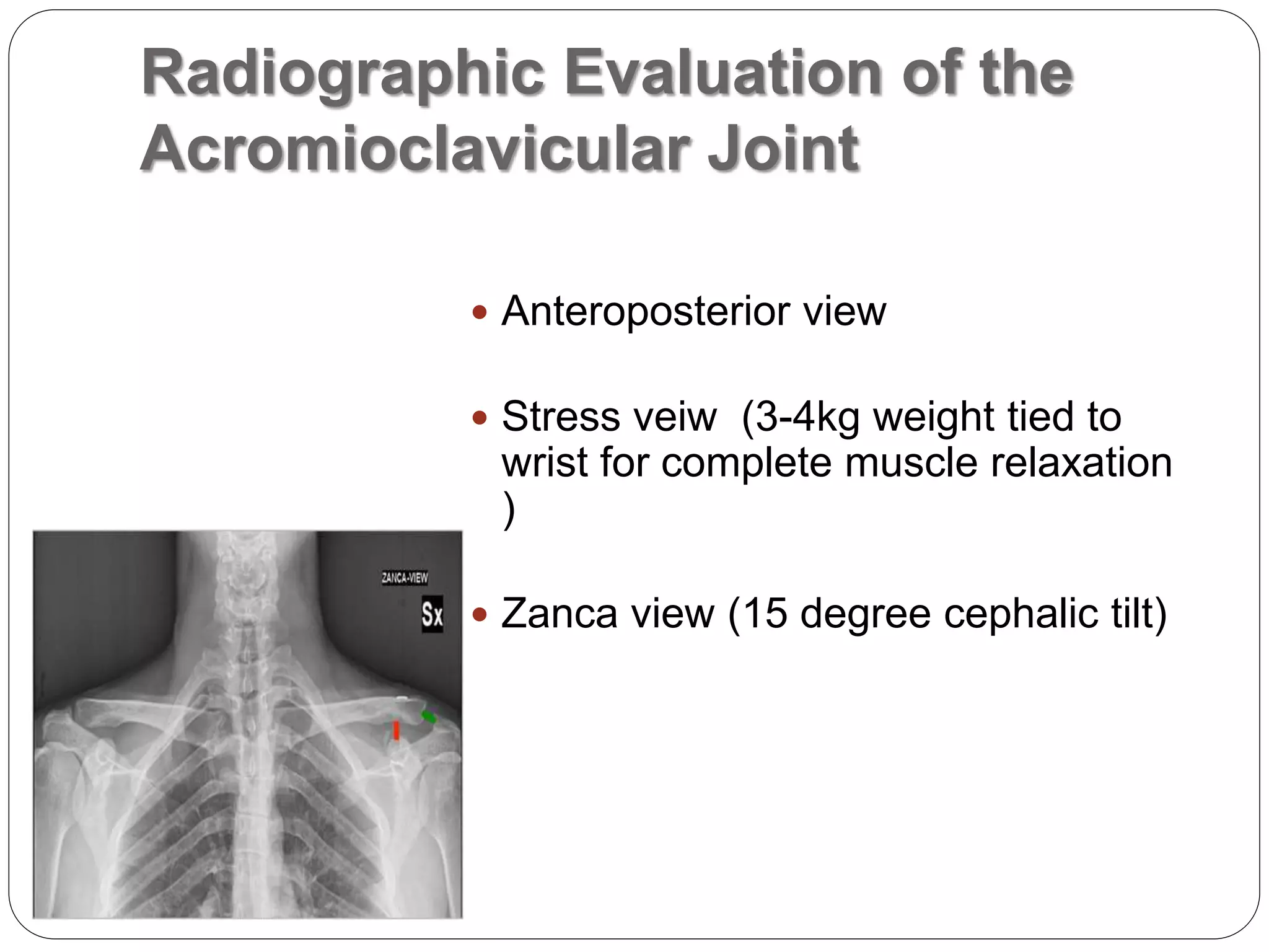 Ac dislocation | PPT