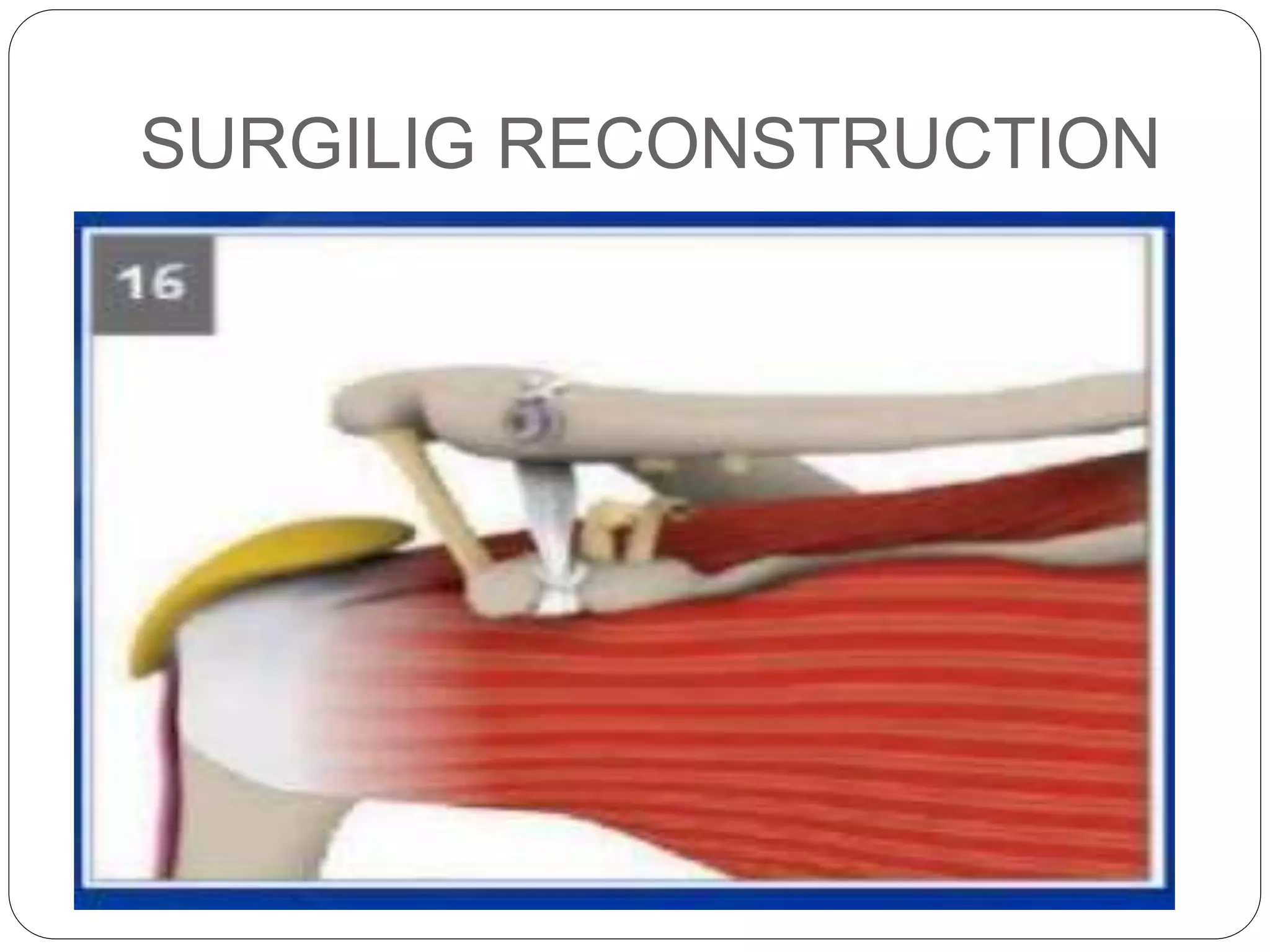 Ac dislocation | PPT