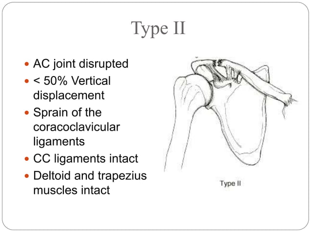 Ac dislocation | PPT