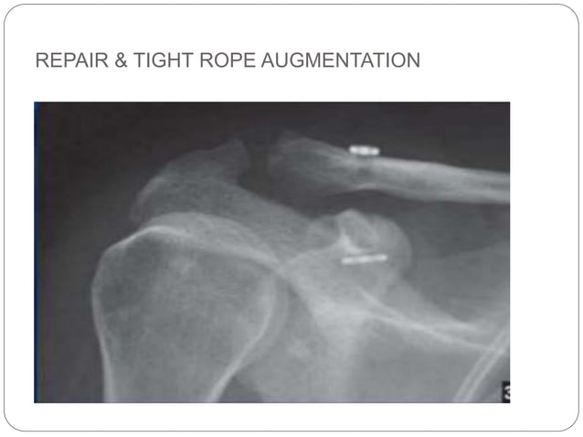 Ac dislocation | PPT