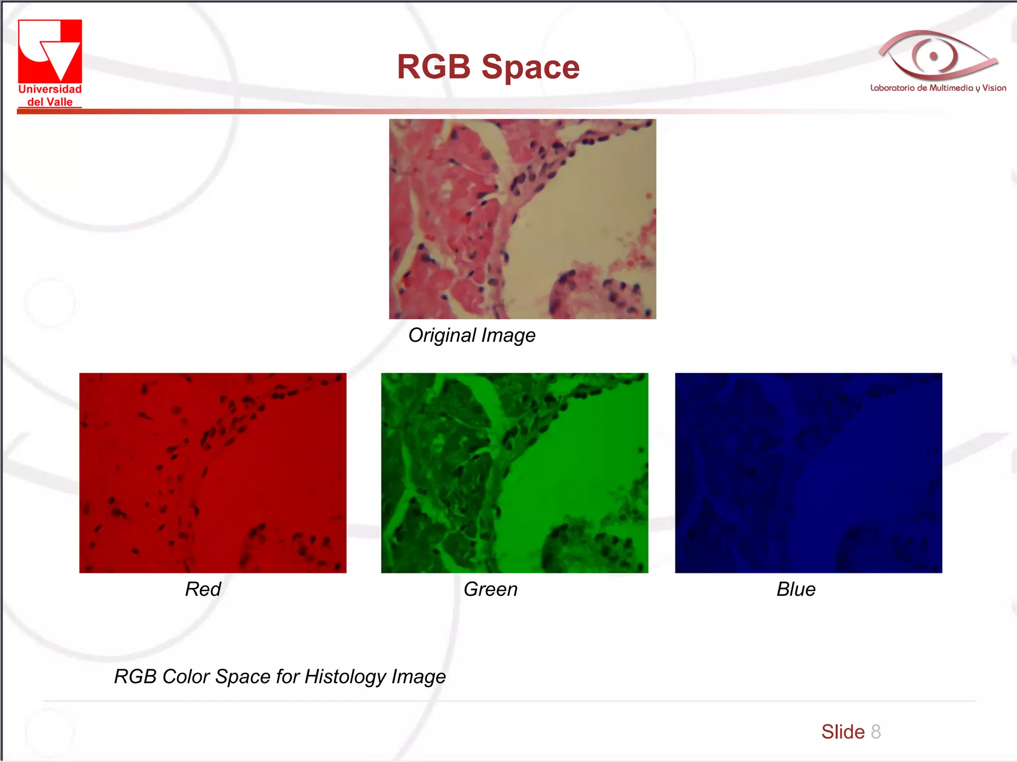 A Cells Segmentation Approach in Epithelial Tissue using Histology ...
