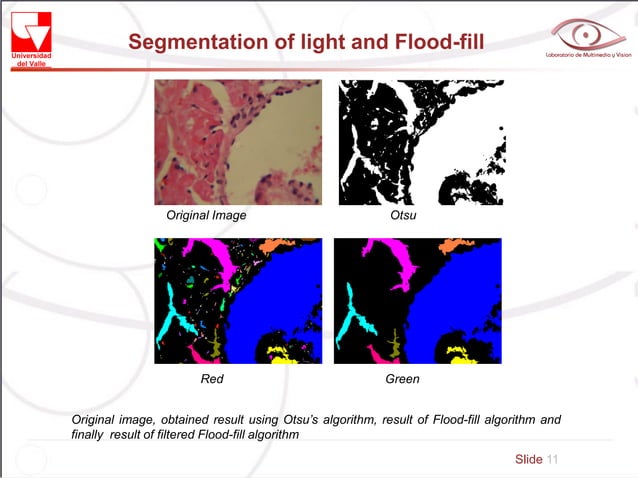 A Cells Segmentation Approach in Epithelial Tissue using Histology ...