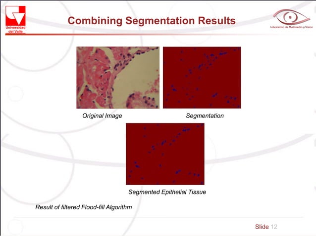 A Cells Segmentation Approach in Epithelial Tissue using Histology ...