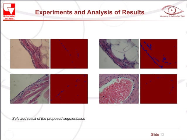 A Cells Segmentation Approach in Epithelial Tissue using Histology ...