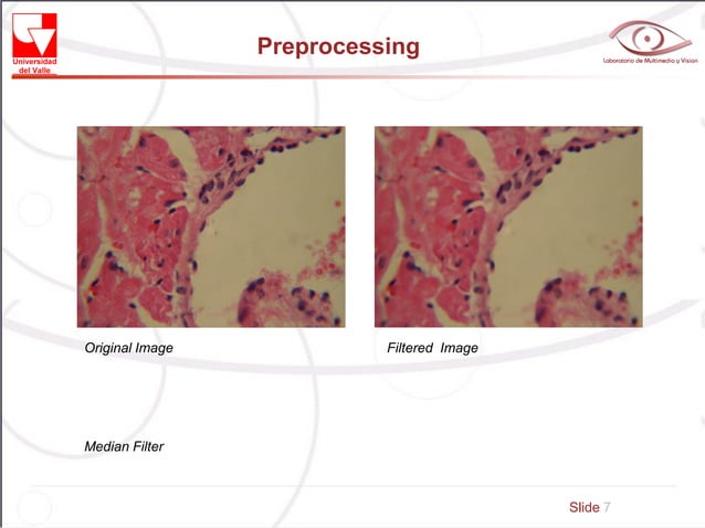 A Cells Segmentation Approach in Epithelial Tissue using Histology ...