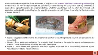 Acellular matrices (for wound management) | PPTX