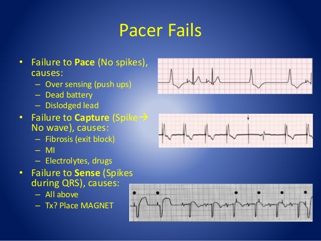 ACEP 2014 Pearls