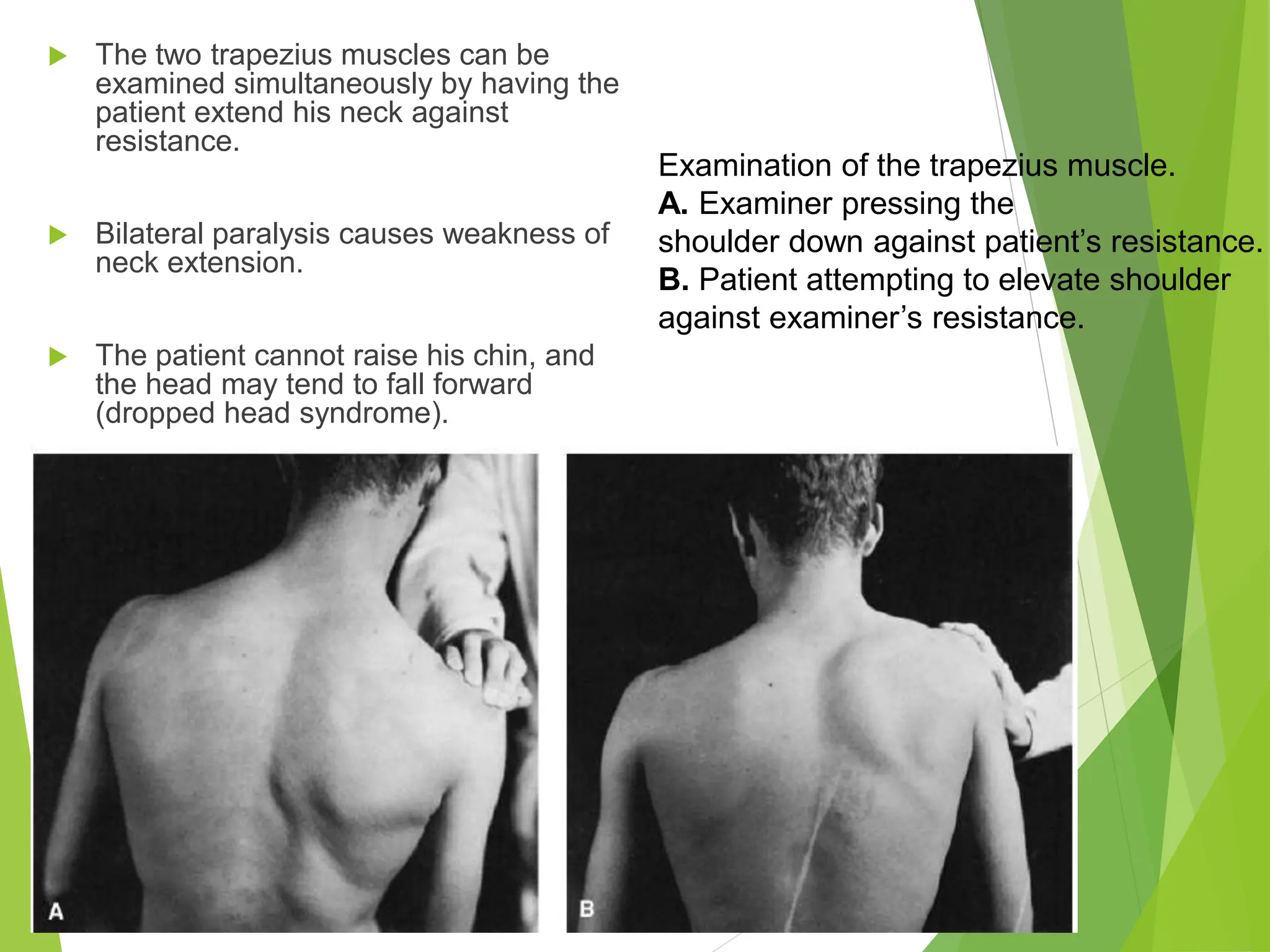 Acessory and Hypoglossal Nerves- Neurology | PPTX