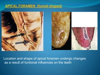 Access cavity ppt | PPTX