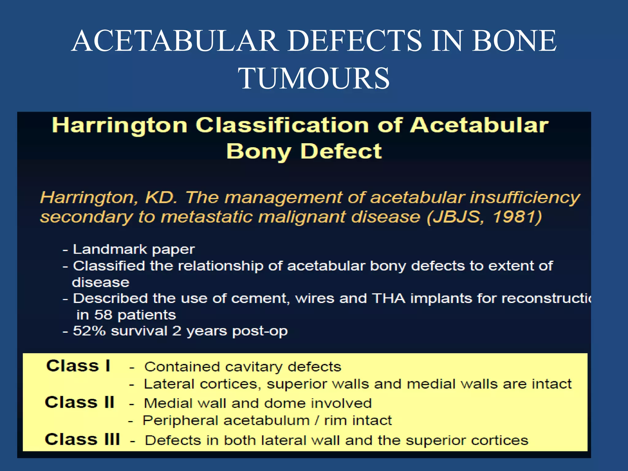 Acetabular defects | PPTX
