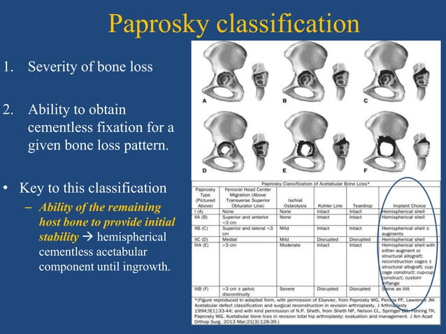 Classification Of Acetabular Defects In Revison Total Hip